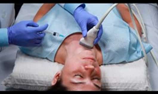 Ultrasound/CT-guided-Biopsy/FNAC/Aspirations | Vascular Interventions