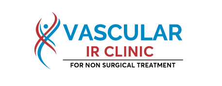 PTBD | Vascular Interventions